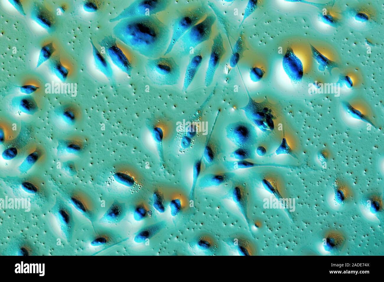 Differential interference contrast (DIC) light micrograph of PC-3 human ...