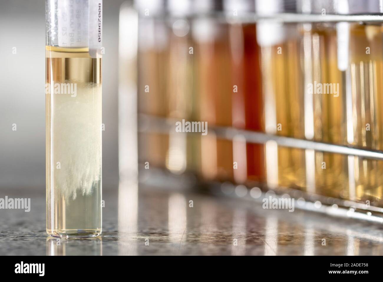 Bacterial growth (mainly Staphylococci) in vials containing nutrient ...