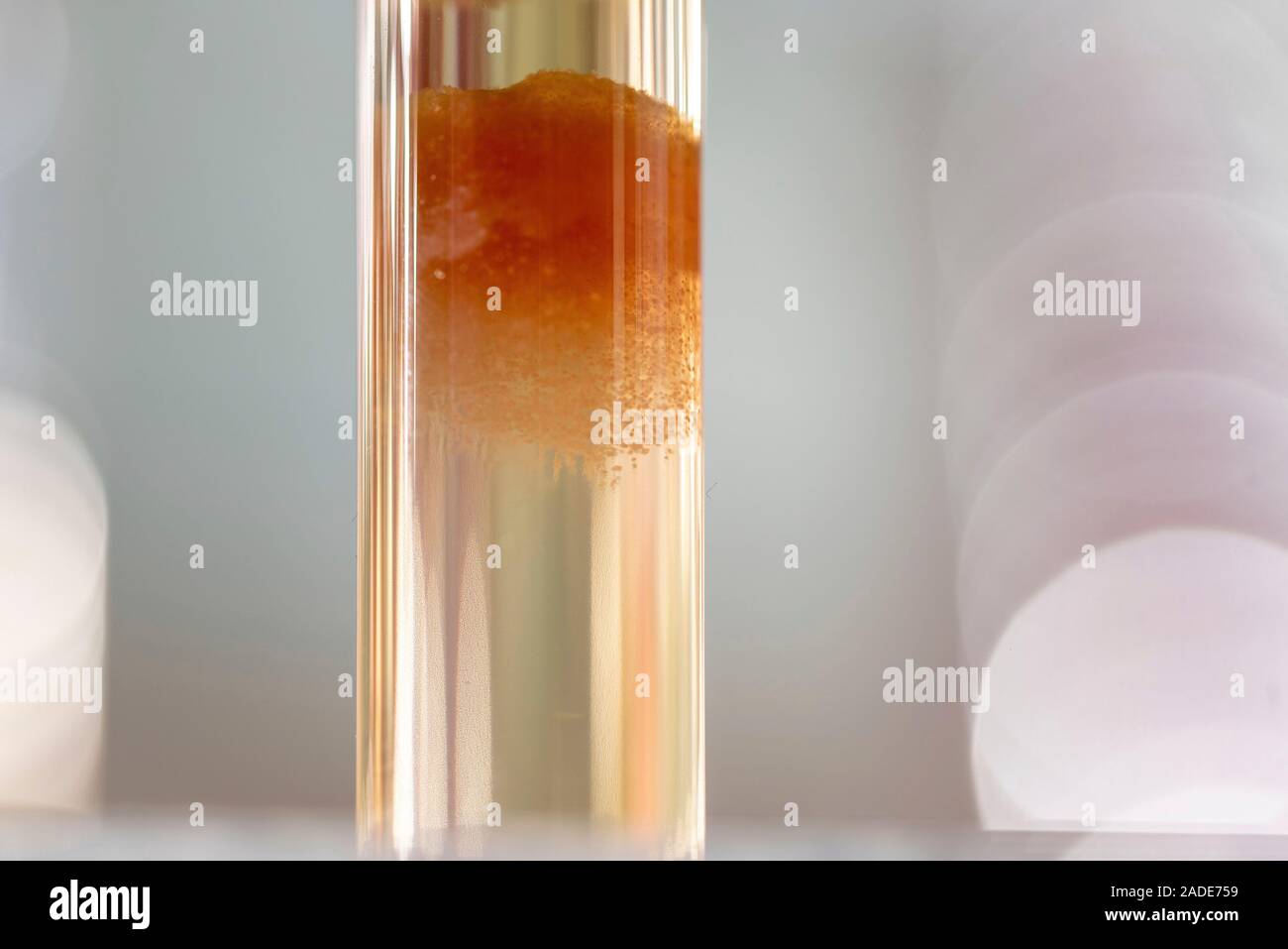 Close-up of bacterial growth (mainly Staphylococci) in a vial ...
