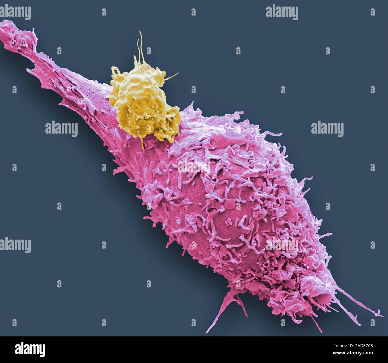 Natural killer (NK) cell interacting with hepatoma cell (HepG2 ...