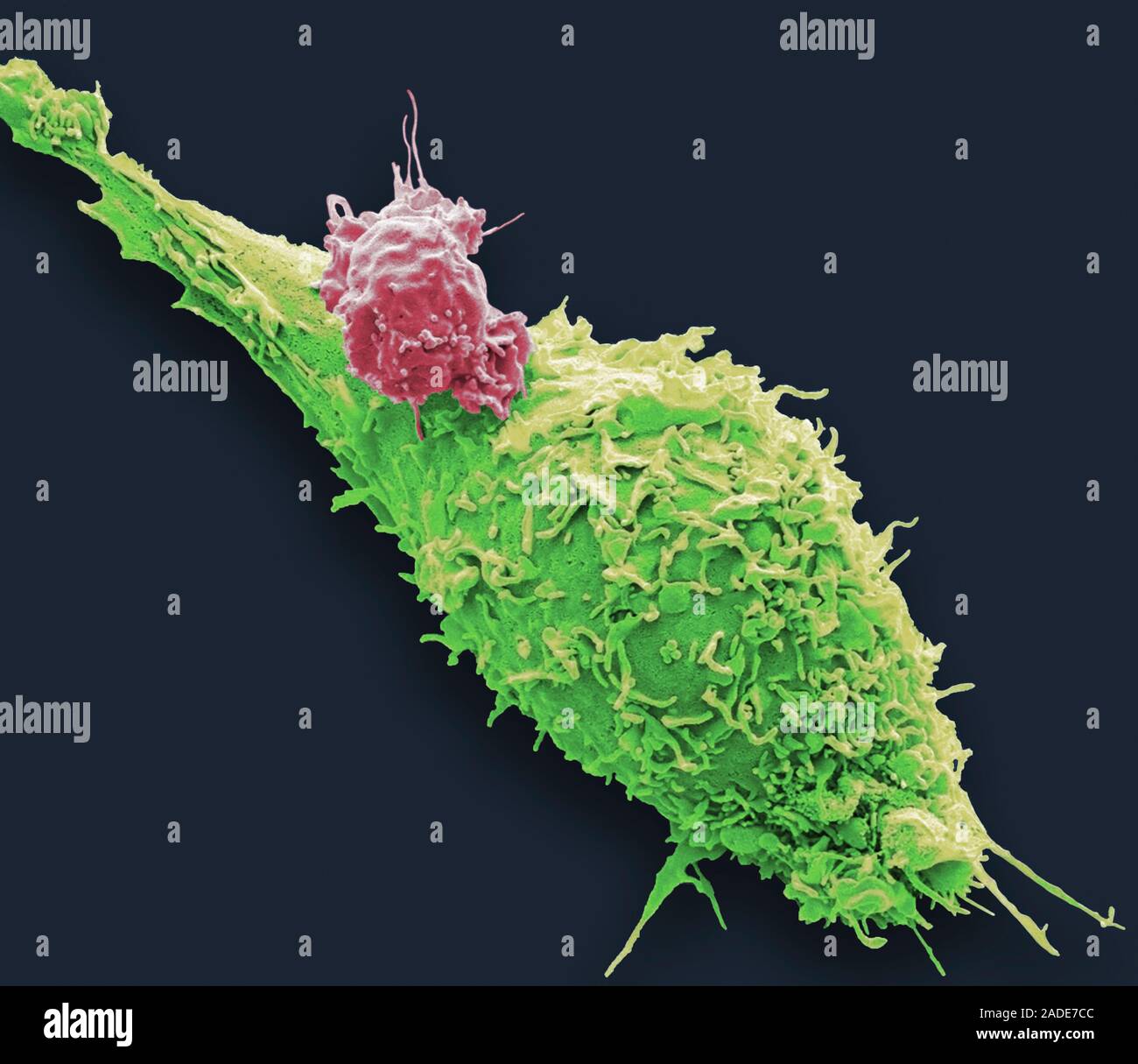 Natural killer (NK) cell interacting with hepatoma cell (HepG2 ...