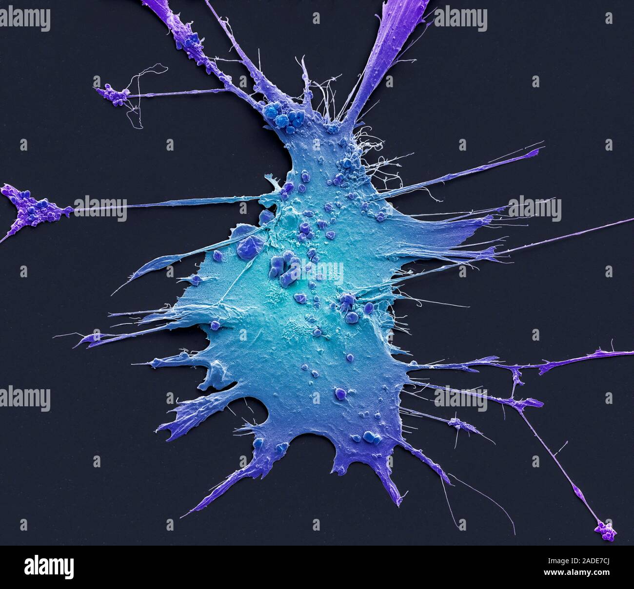 Hepatic stellate cell. Scanning electron micrograph (SEM) of a Hepatic ...