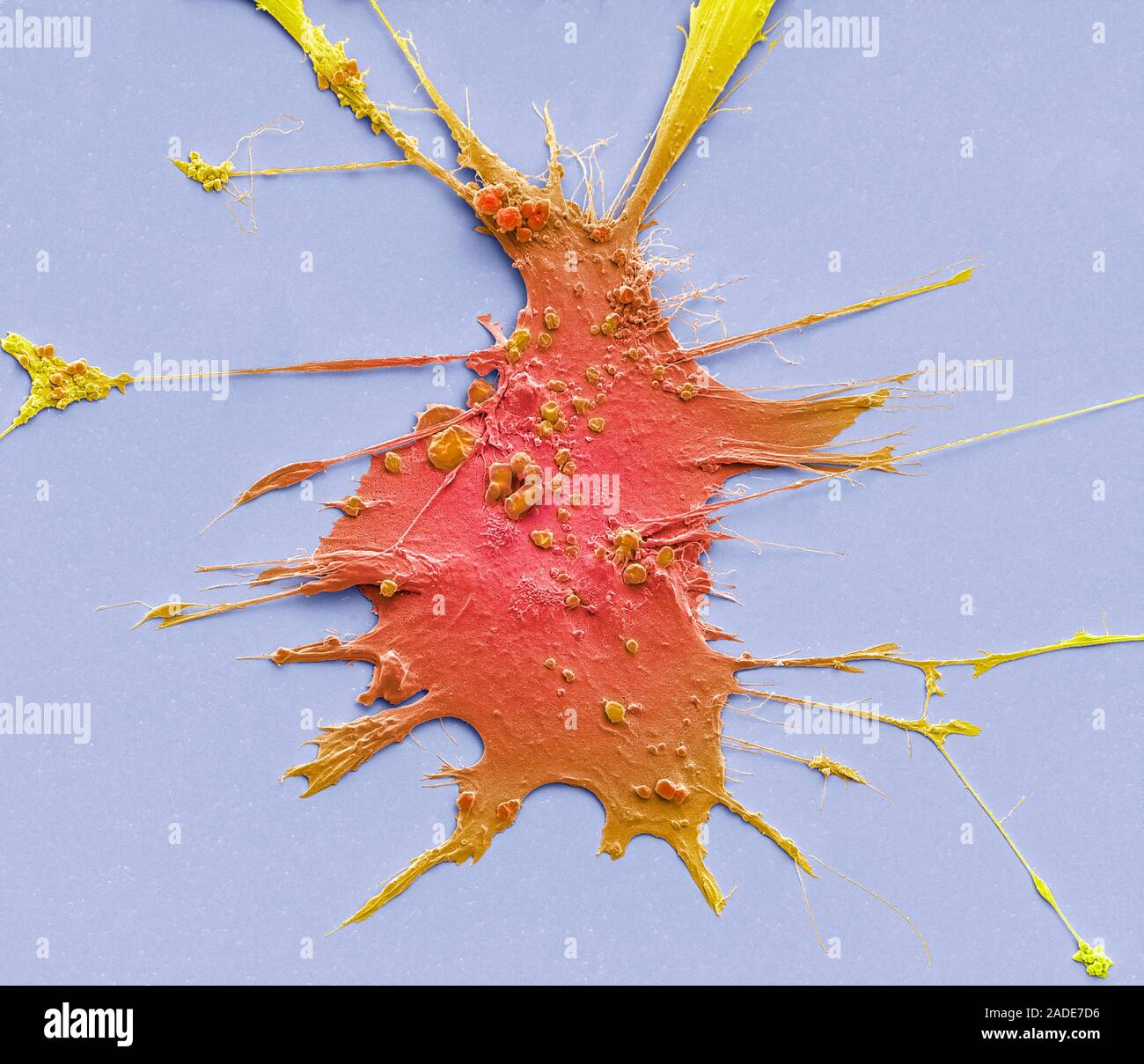 Hepatic stellate cell. Scanning electron micrograph (SEM) of a Hepatic ...