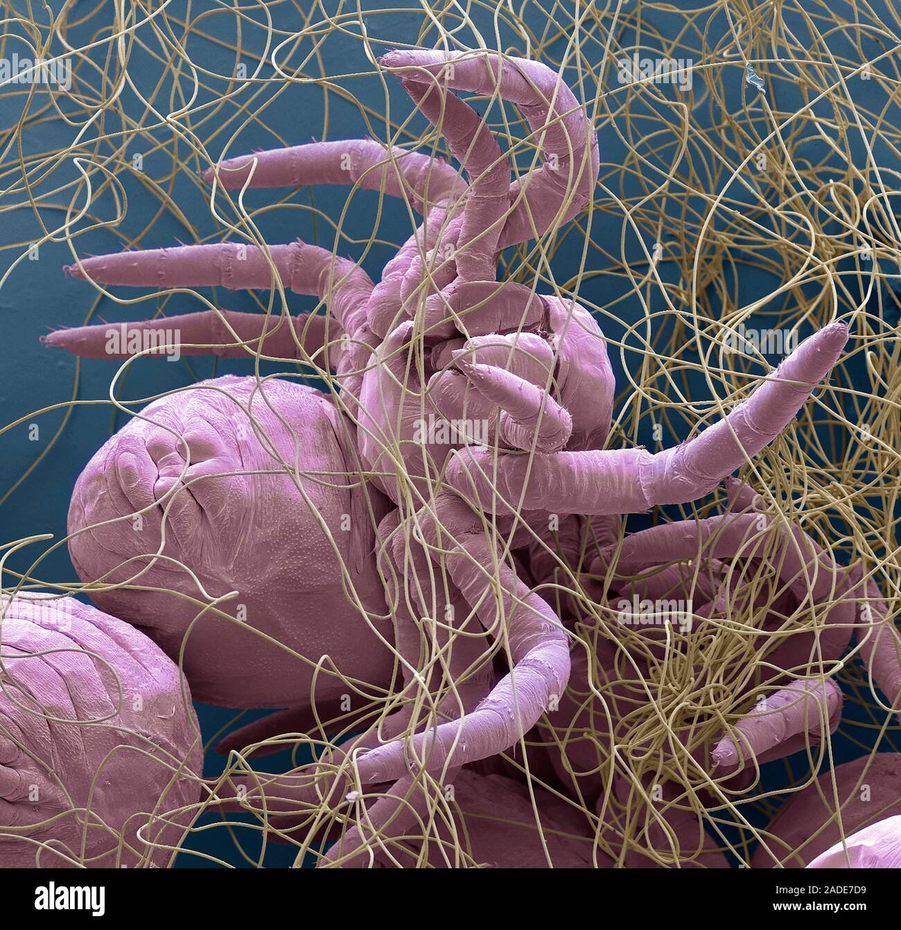 Newly hatched spiderling. Coloured scanning electron micrograph (SEM ...