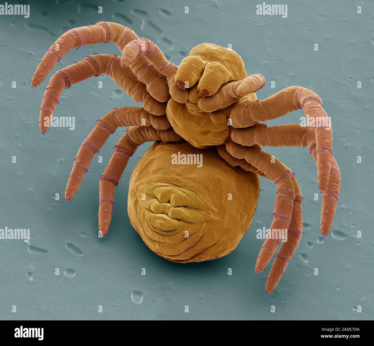 Newly hatched spiderling. Coloured scanning electron micrograph (SEM ...