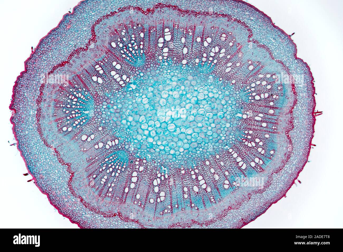 Annual Stem Of Eucalyptus. Light micrograph of a cross-section through ...