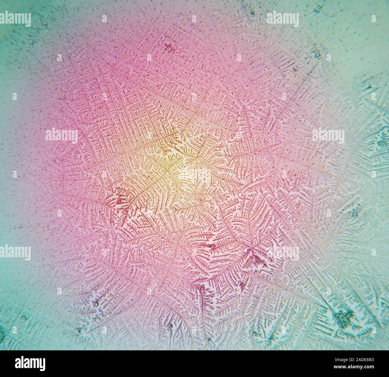 Images not to be used by the tobacco industry. Human saliva displaying ...