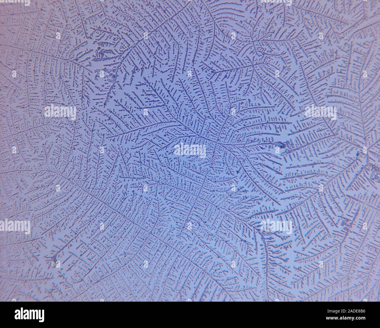 Images not to be used by the tobacco industry. Human saliva displaying ...