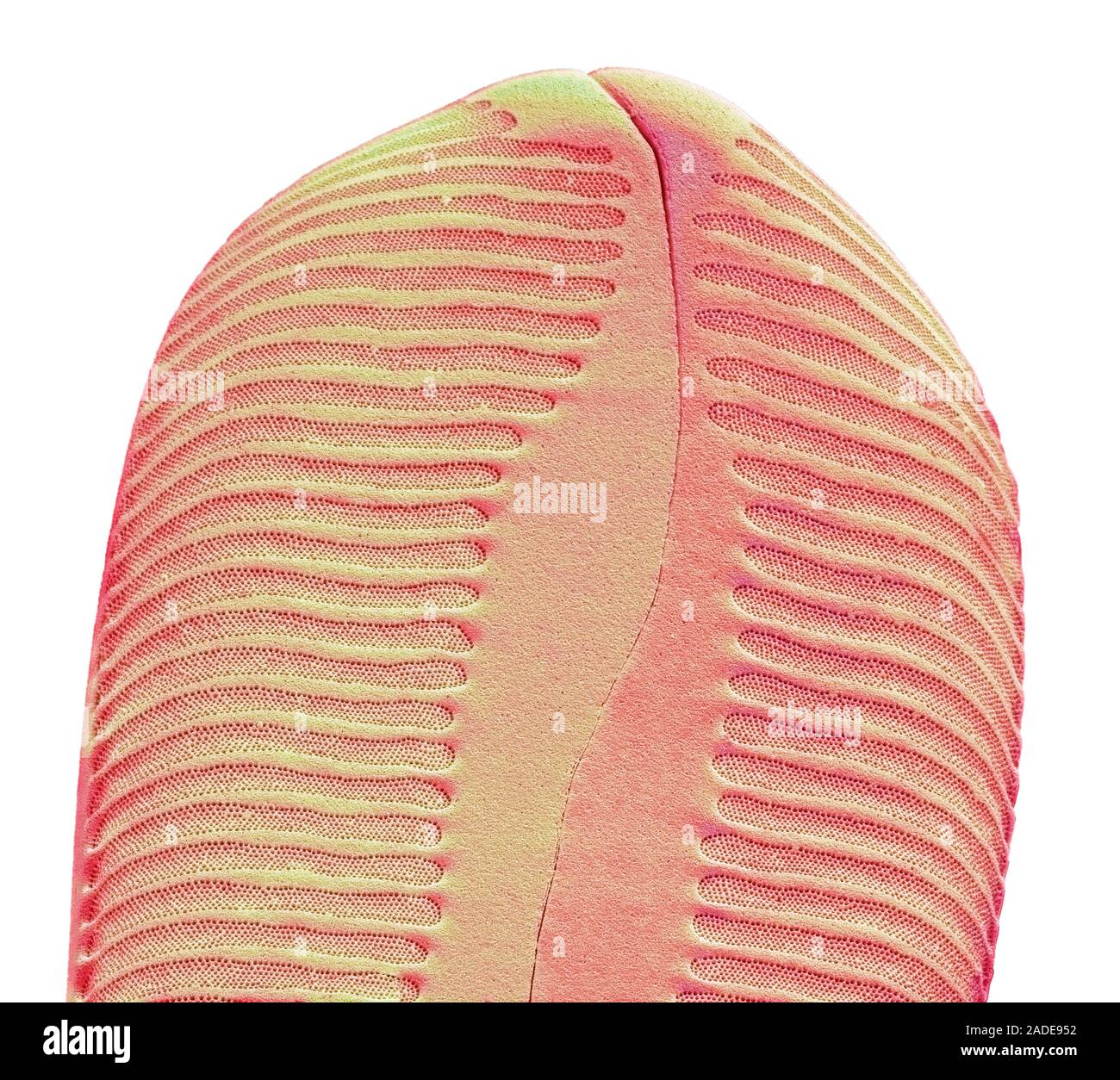 Diatom. Coloured scanning electron micrograph (SEM) of an unknown ...