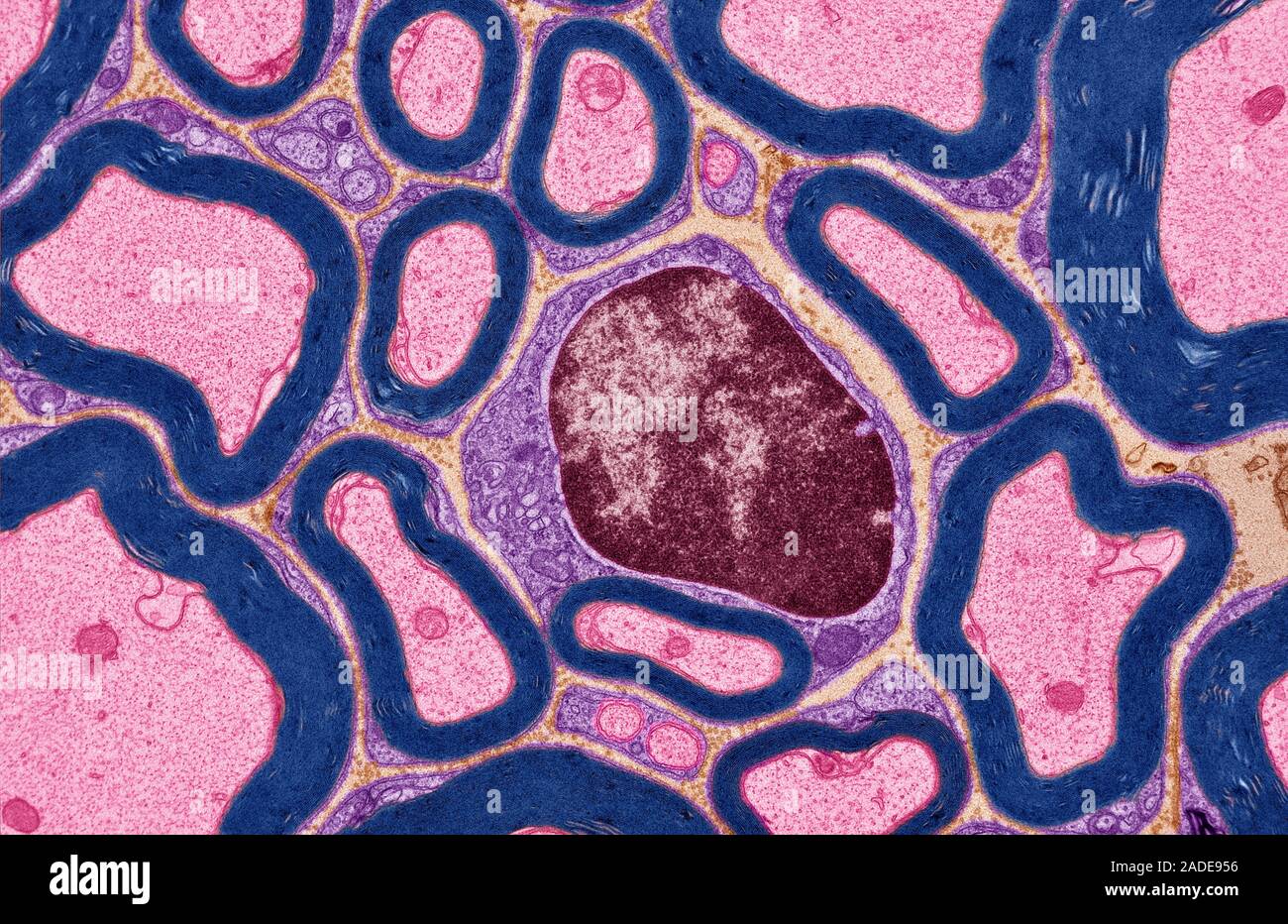 Peripheral nerve. Coloured transmission electron micrograph (TEM) of a ...