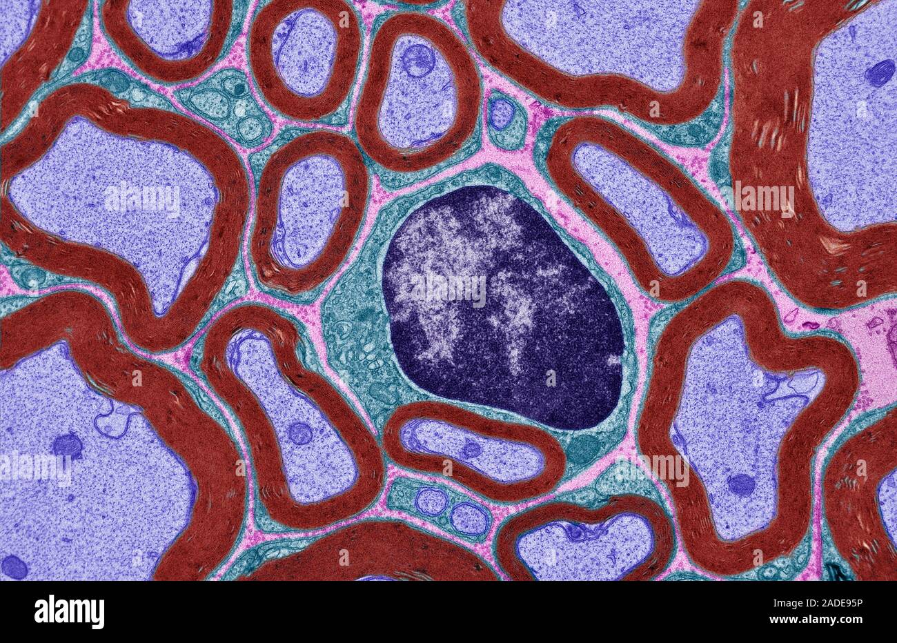Peripheral nerve. Coloured transmission electron micrograph (TEM) of a ...