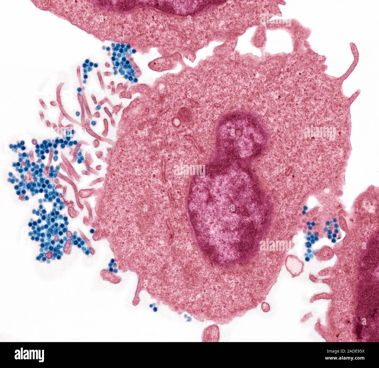 Epstein-Barr virus particles. Coloured transmission electron micrograph ...