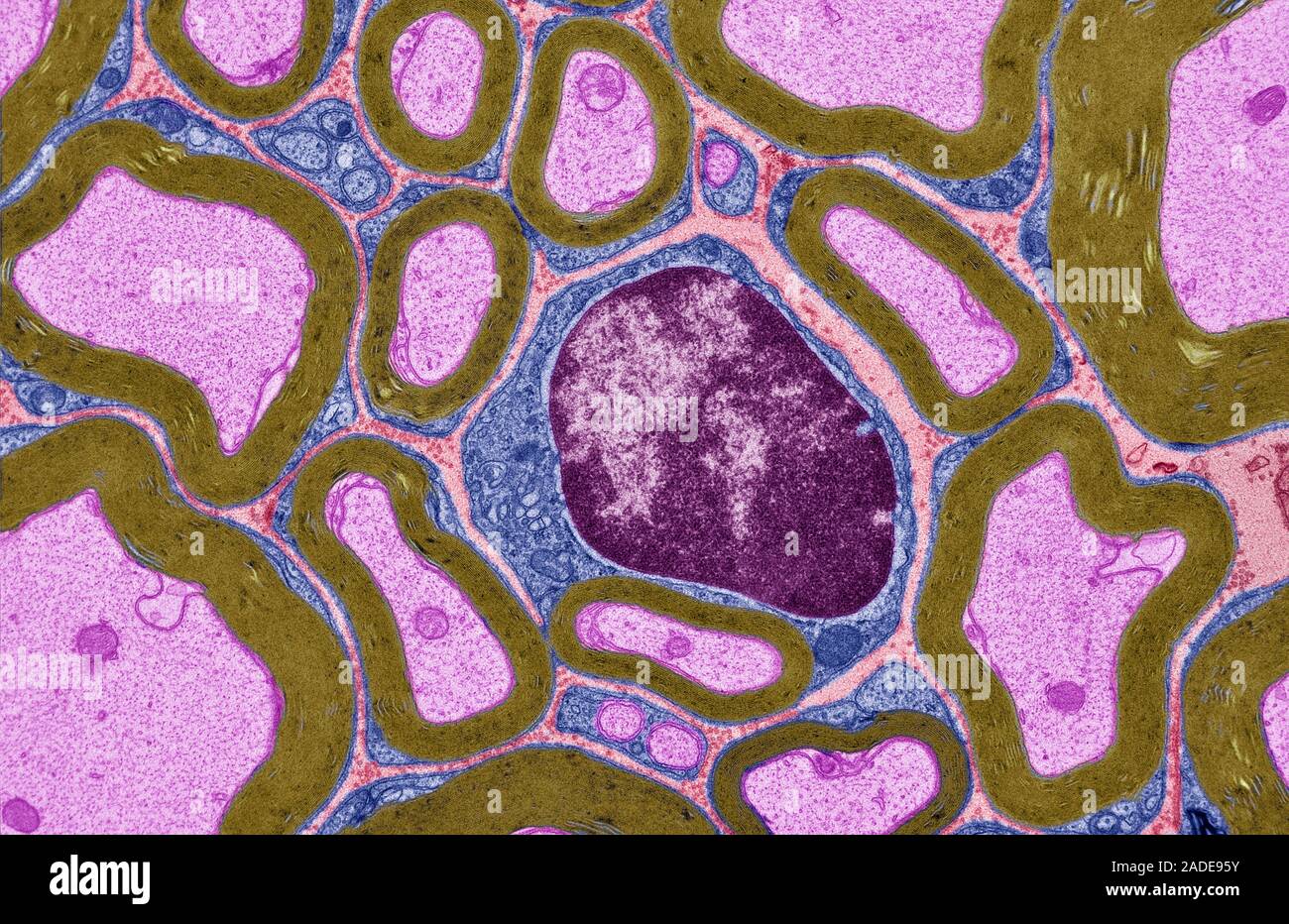 Peripheral nerve. Coloured transmission electron micrograph (TEM) of a ...