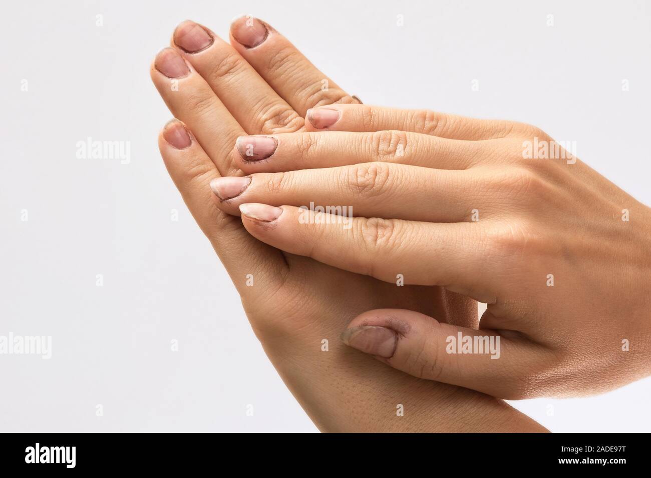 Female hands with dirty nails in studio Stock Photo - Alamy