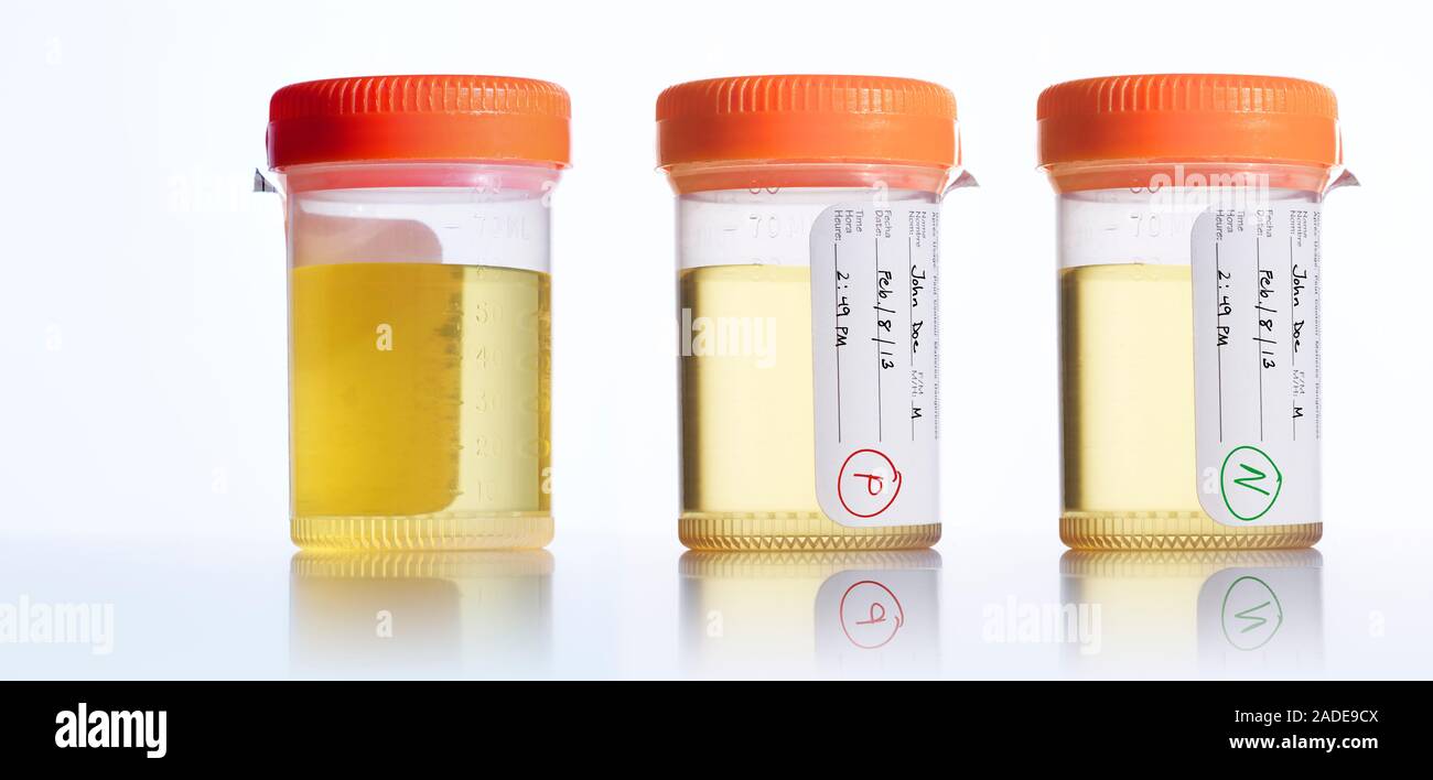Drug test containers with positive, negative and neutral markings Stock ...