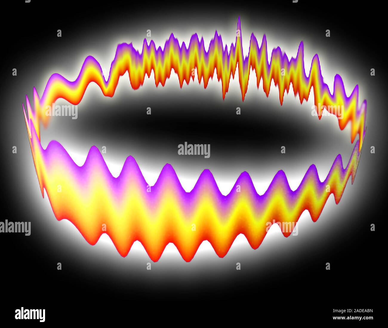 Visual Aura Due To Migraine Illustration The Zig Zag Multicoloured Lines Are A Representation