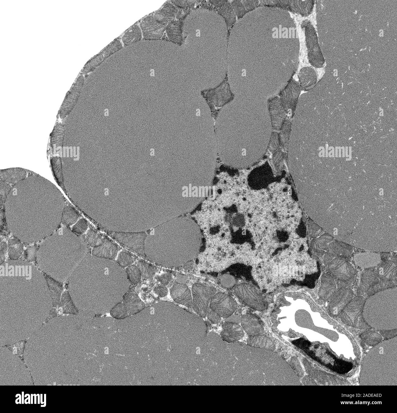 Fat cells. Black and white transmission electron micrograph (TEM) of a ...
