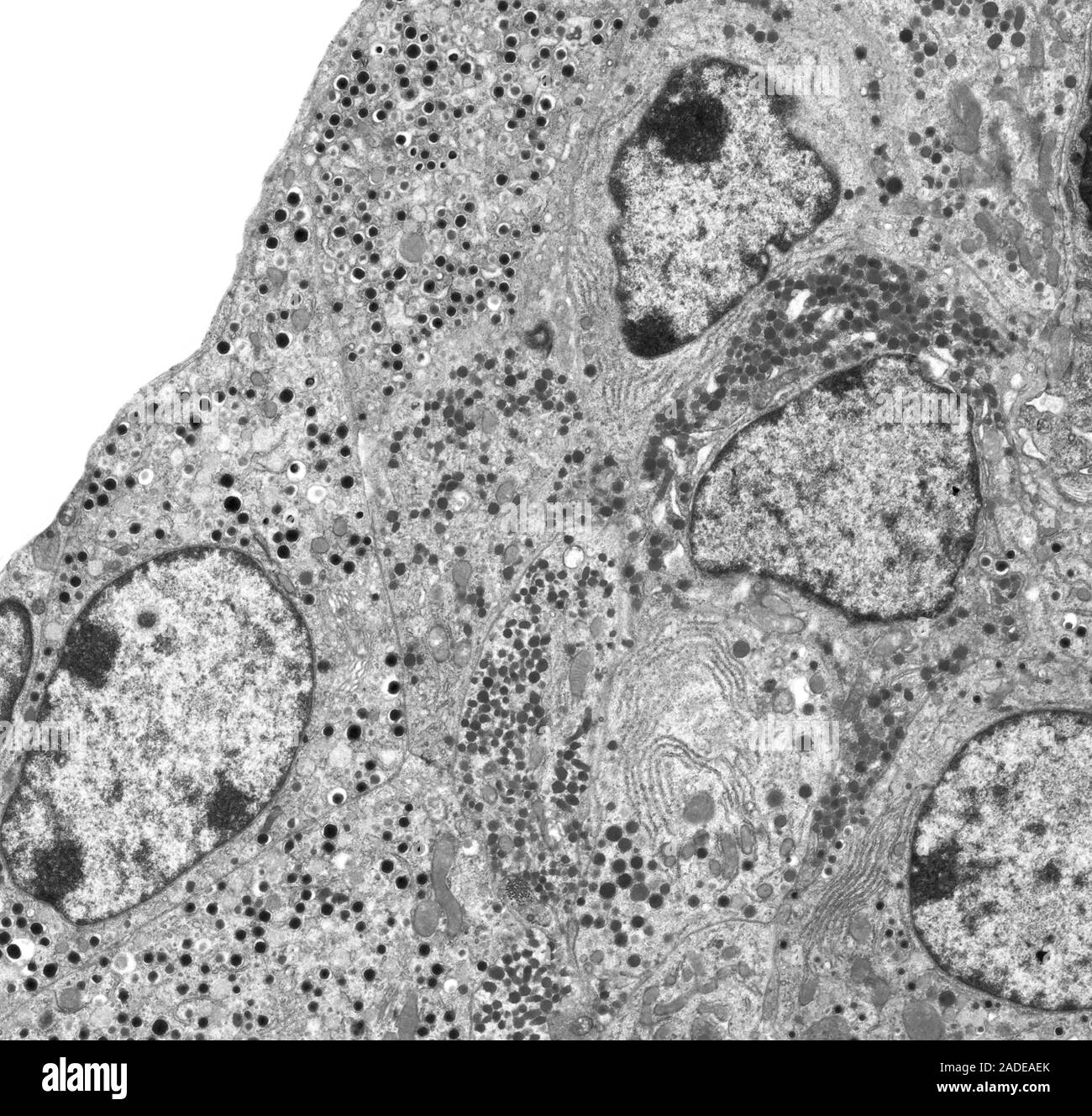 Pancreatic islet cells. Black and white transmission electron ...
