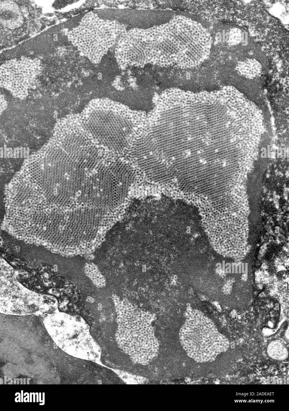 Papilloma virus particles. Black and white transmission electron ...