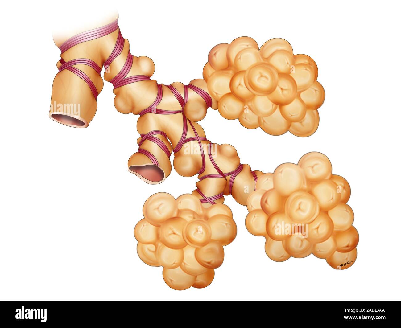 Bronchoconstriction in the lungs. Illustration of lung bronchioles and ...