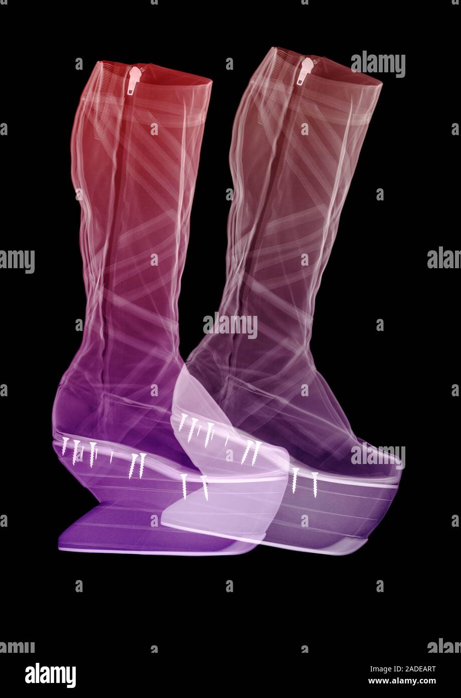 Wedge knee-high boots, coloured X-ray Stock Photo - Alamy