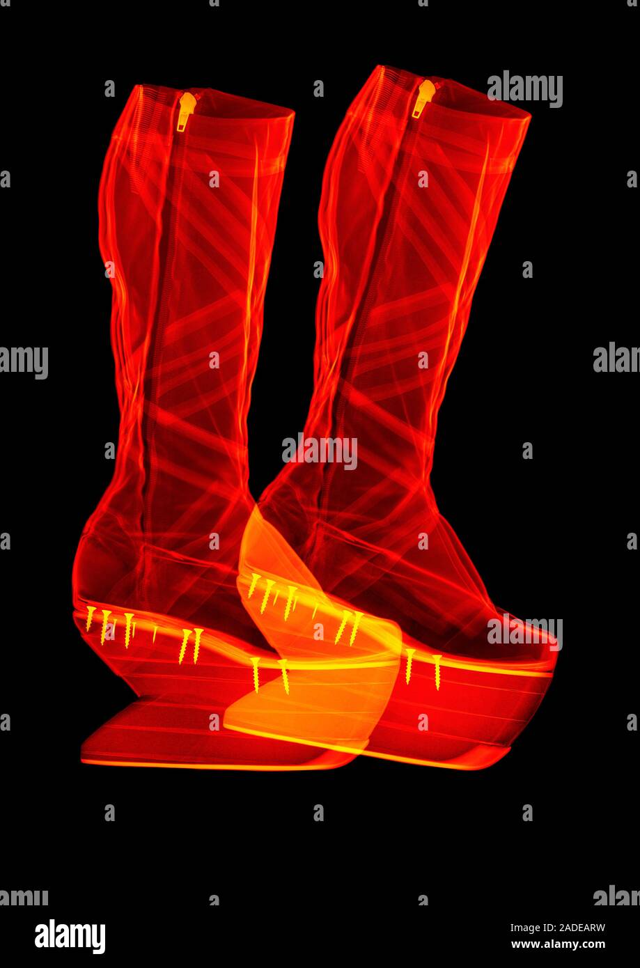 Wedge knee-high boots, coloured X-ray Stock Photo - Alamy