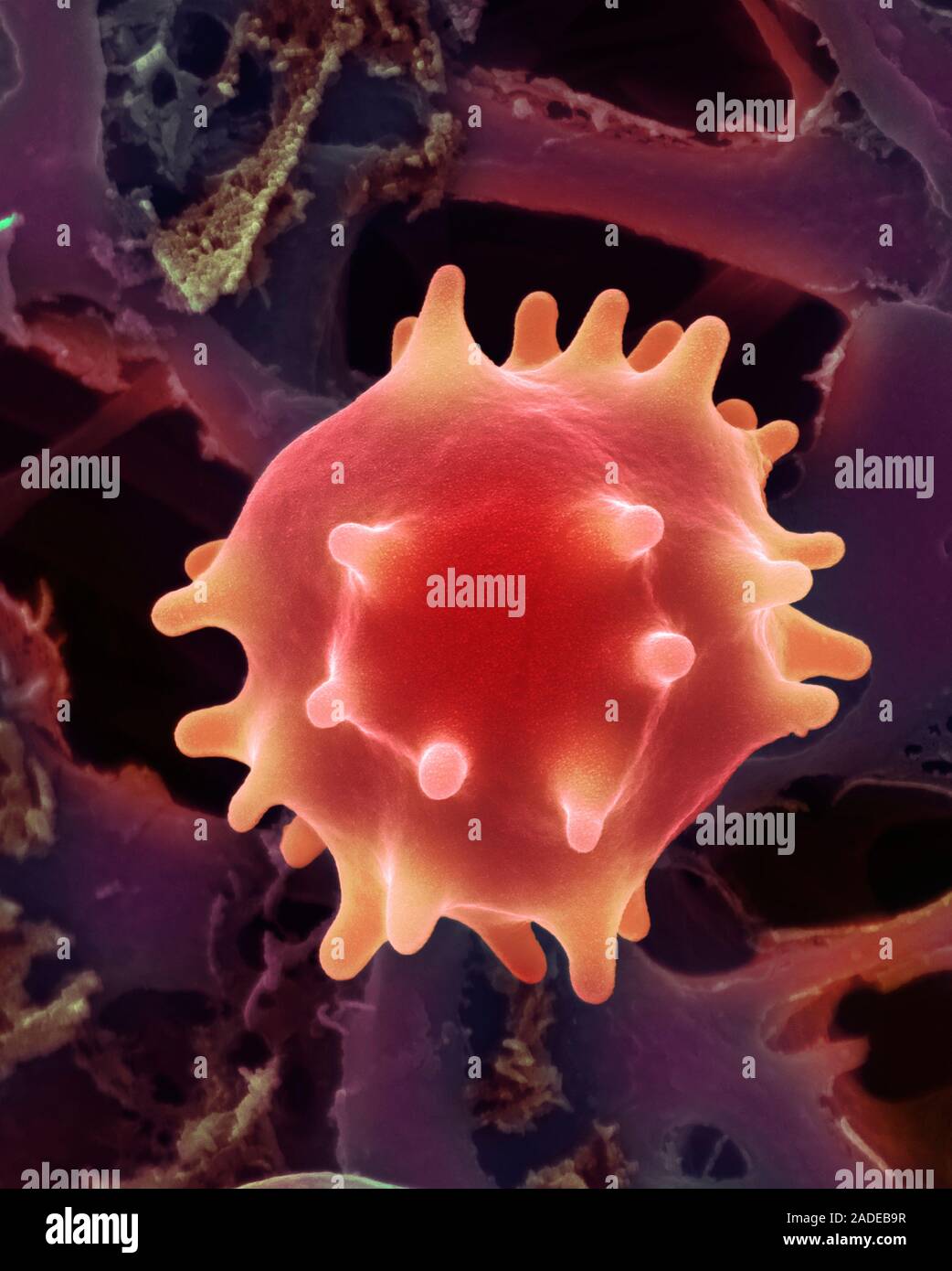Crenate red blood cell (echinocyte), coloured scanning electron ...