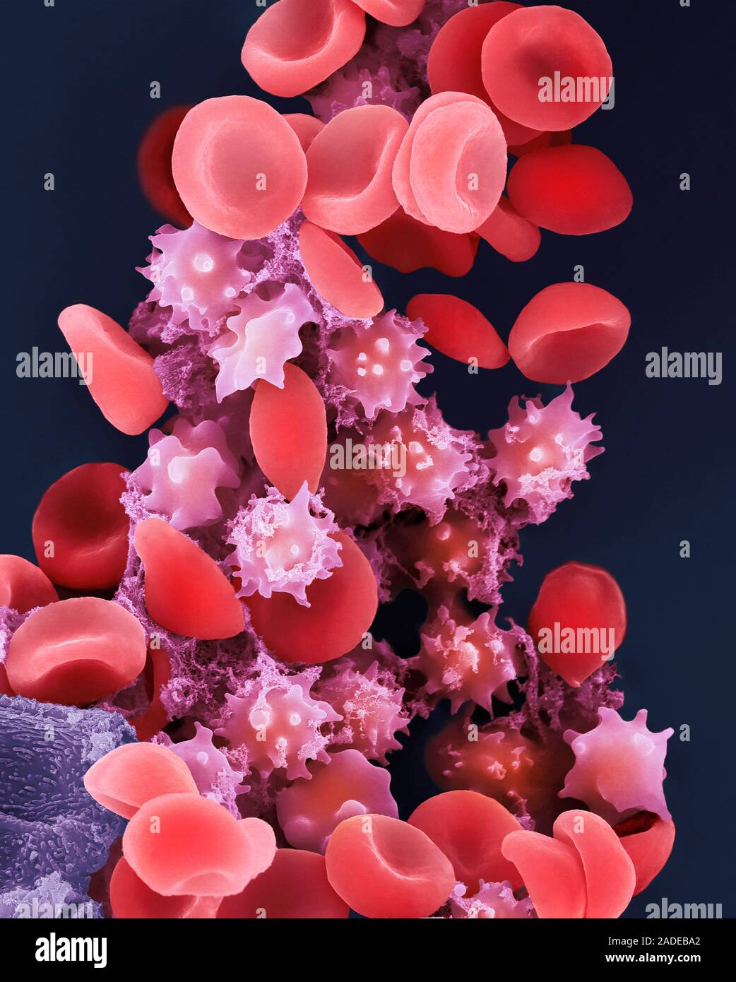 Crenate red blood cells (echinocytes), coloured scanning electron ...