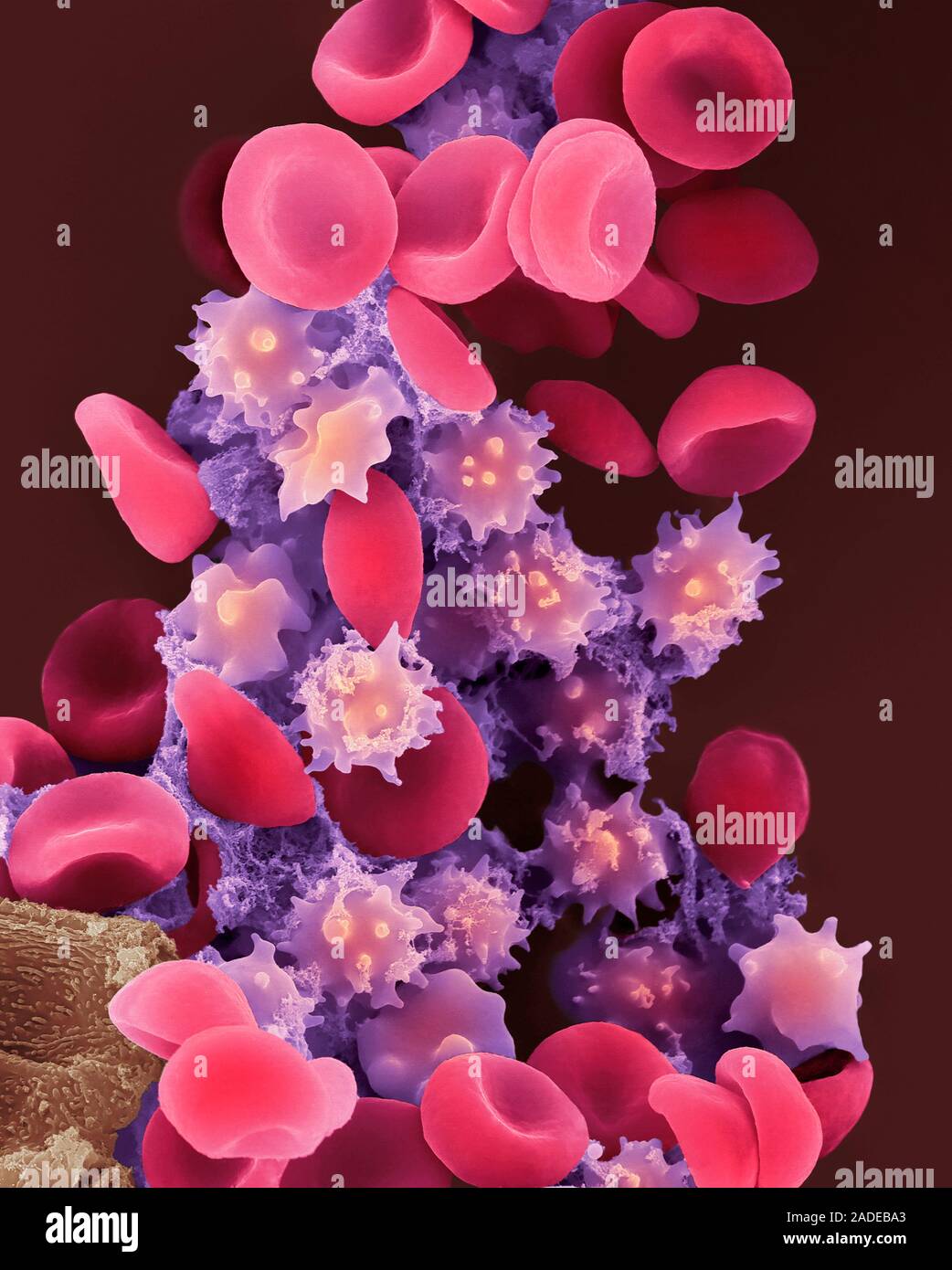 Crenate red blood cells (echinocytes), coloured scanning electron ...