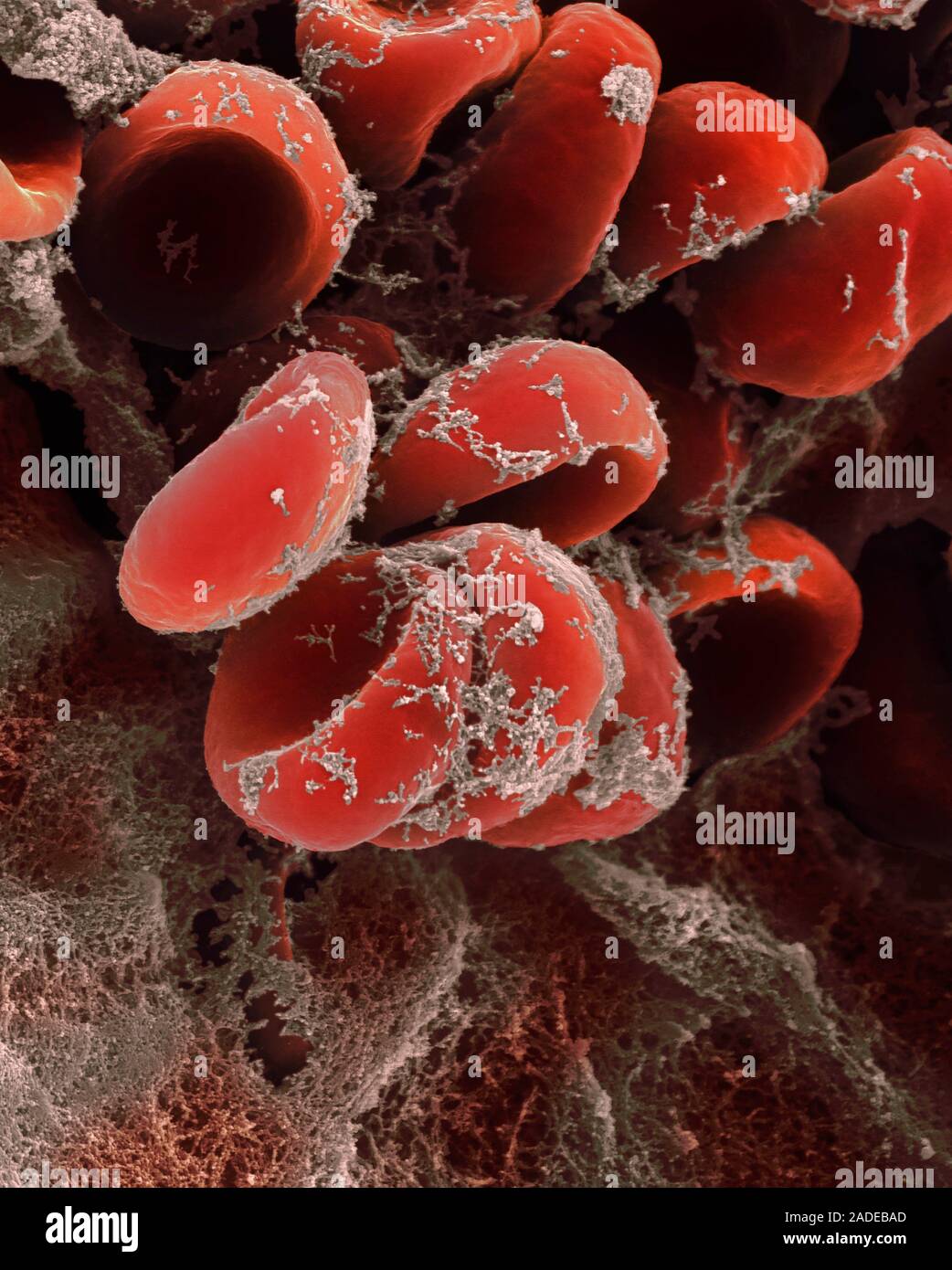 Coloured scanning electron micrograph (SEM) of red blood cells in a ...