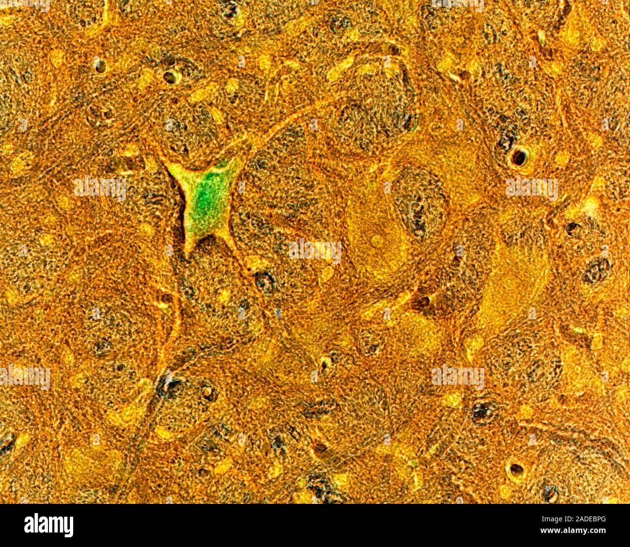 Astrocyte cell in brain tissue, light micrograph. The astrocyte cell ...