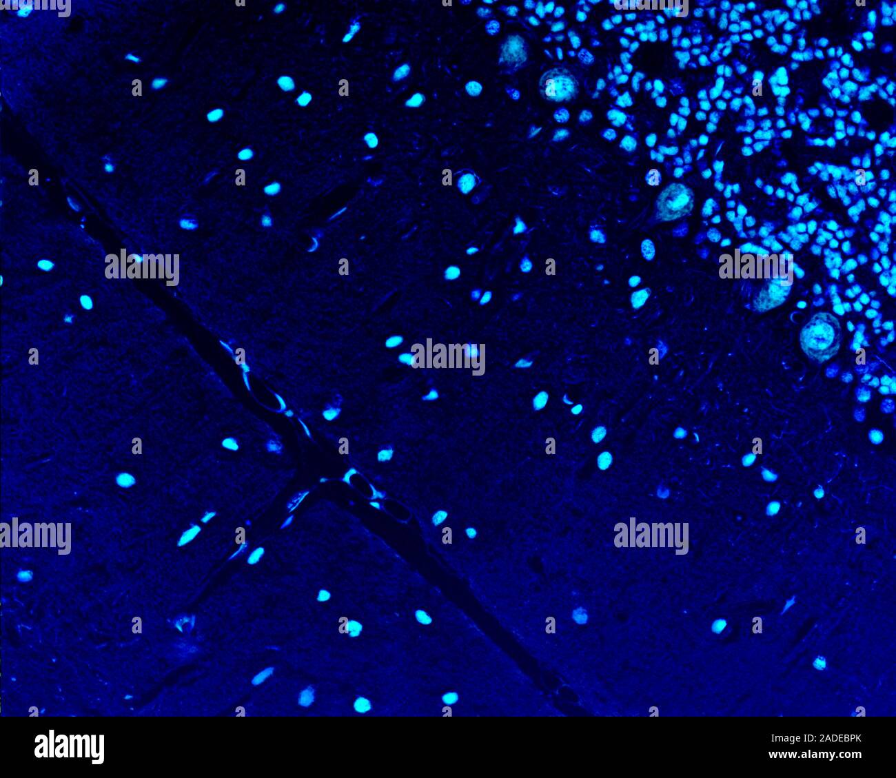 Cerebellum brain cells, light micrograph. This sample has been prepared ...