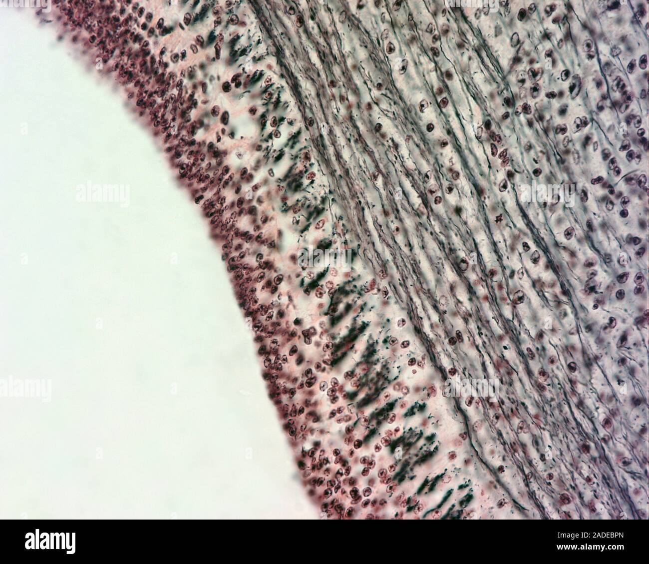 Spinal cord nerve cells, light micrograph. This tissue sample is from a ...