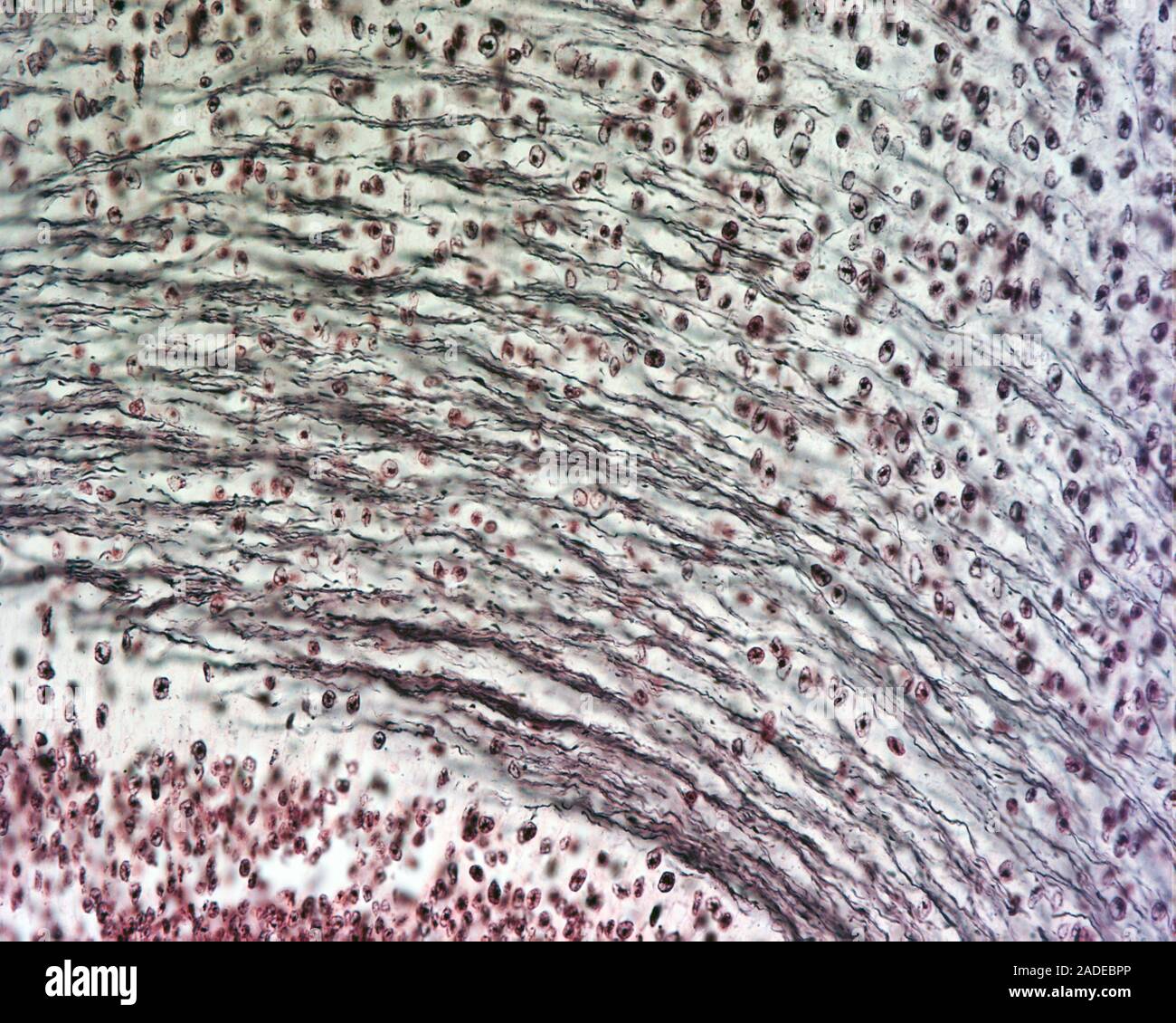 Spinal cord nerve cells, light micrograph. This tissue sample is from a ...