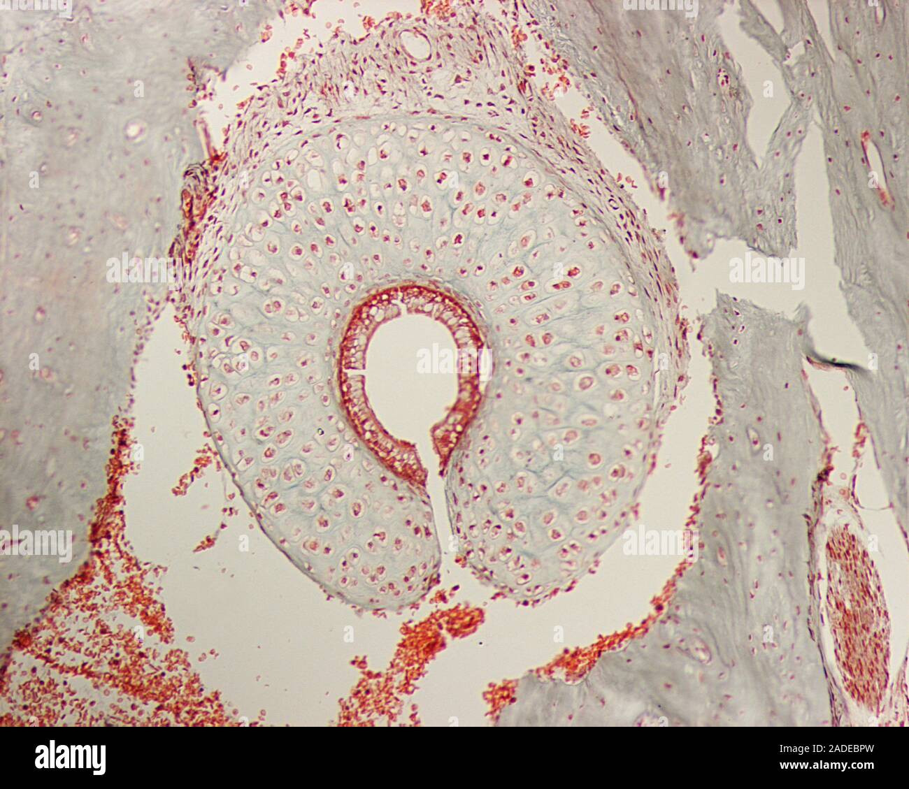 Cochlea cartilage, light micrograph. Cartilage is an elastic tissue ...