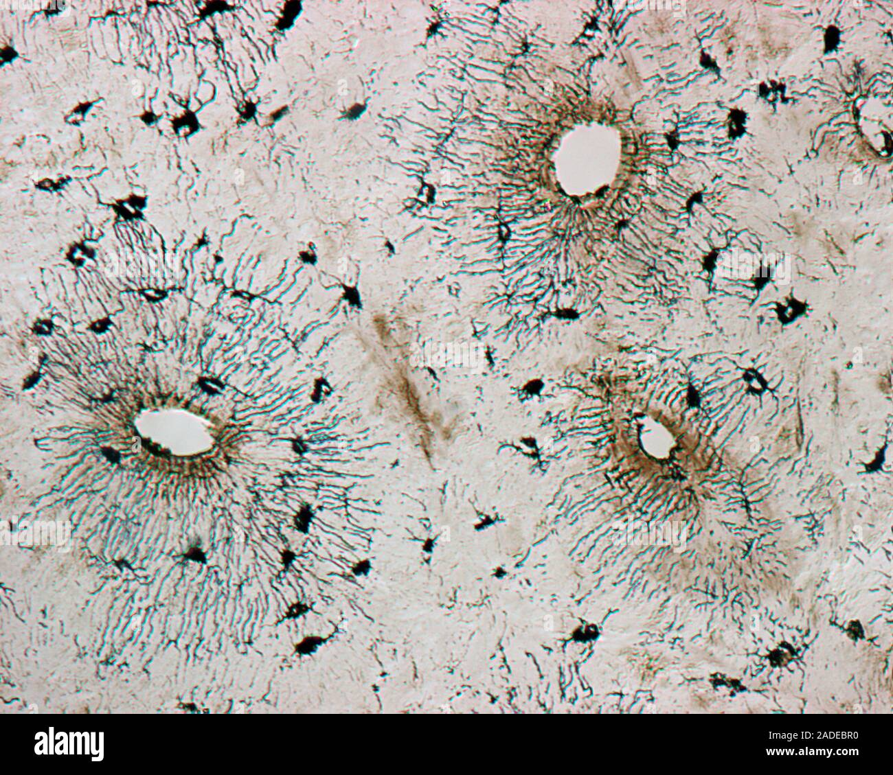 Compact bone, light micrograph. Bone is a dense matrix of calcium ...