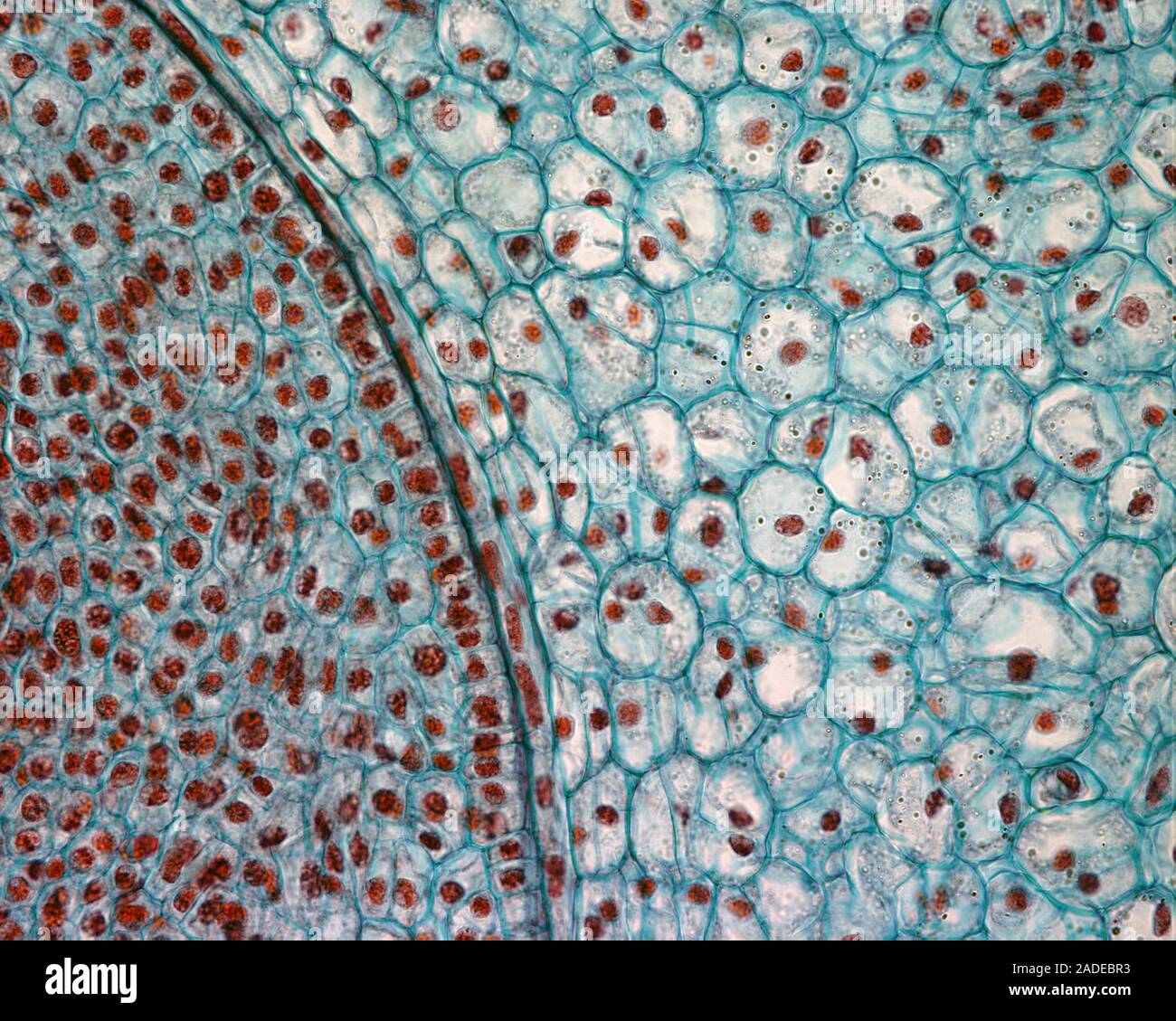 Section through flower ovary, light micrograph. Ovaries are the female ...
