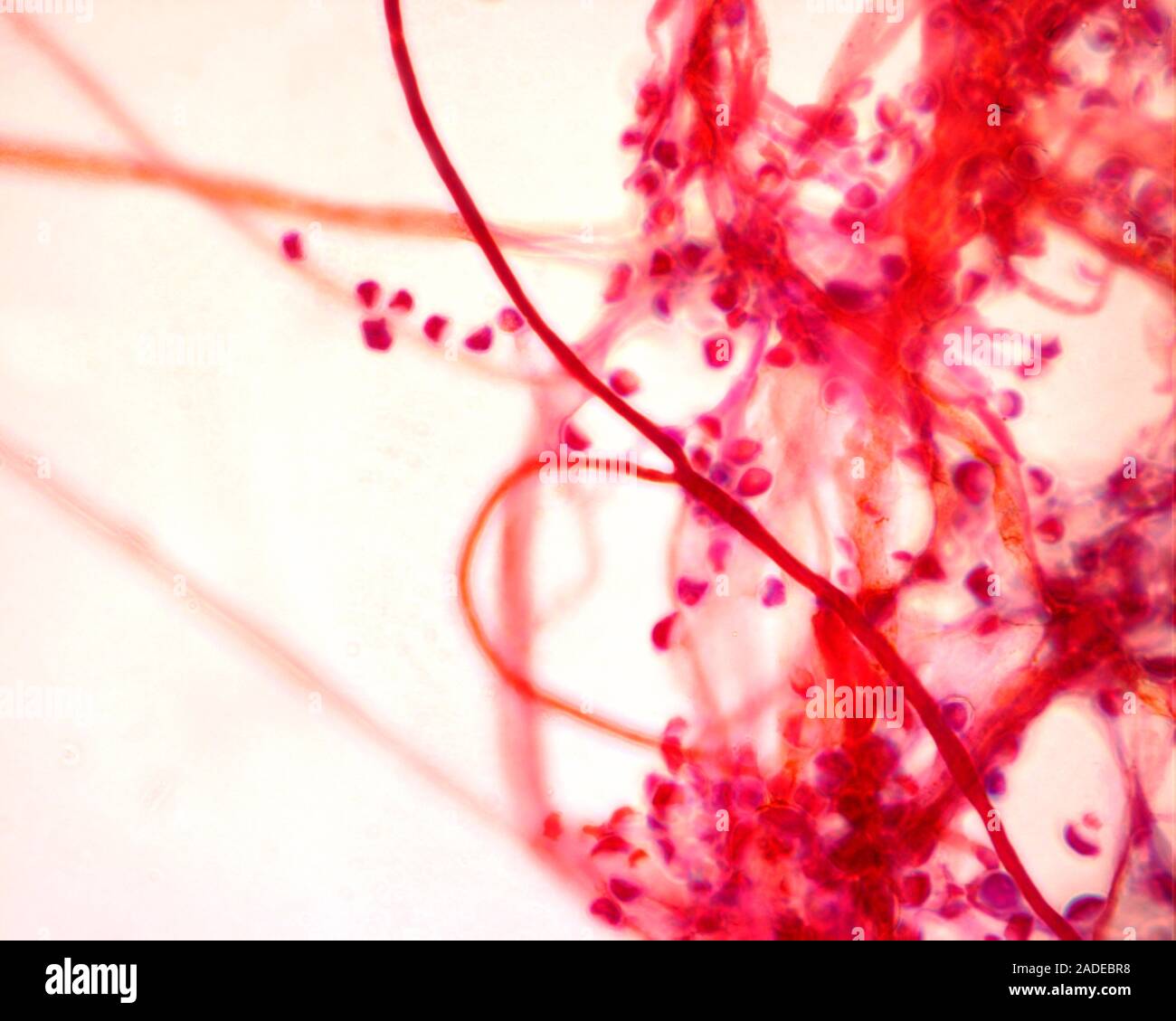 Aspergillus fungus, light micrograph. The fungus Aspergillus niger ...