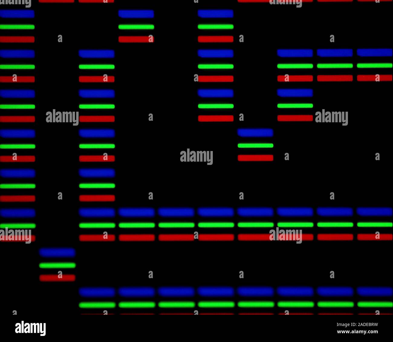 Liquid crystal display grid. Light micrograph of part of the grid of ...