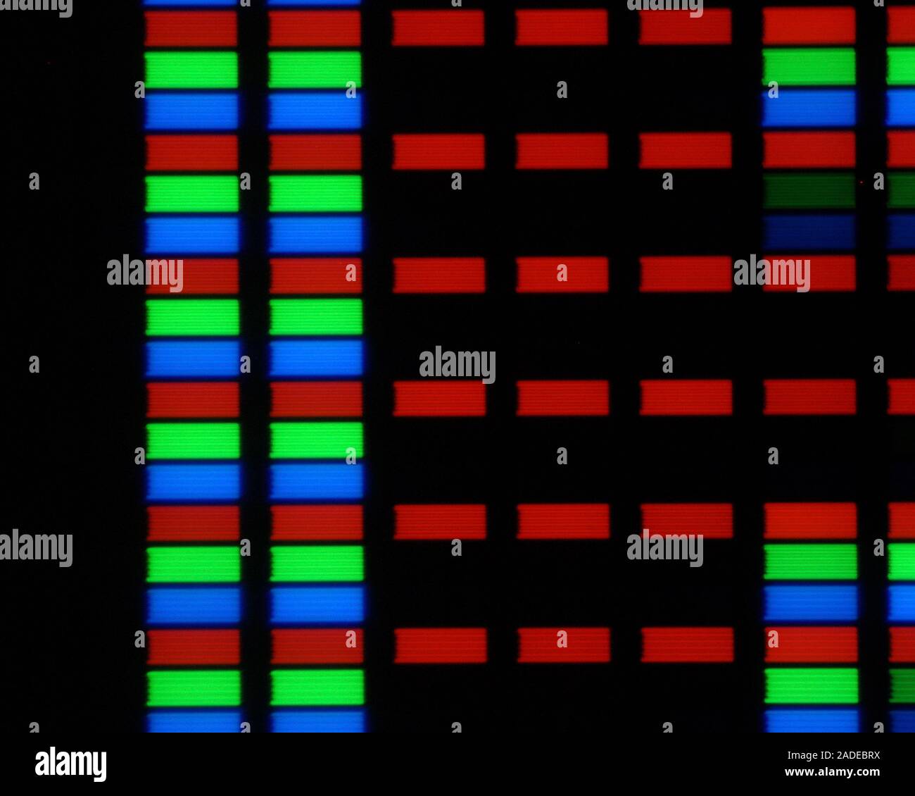 Liquid crystal display grid. Light micrograph of part of the grid of ...