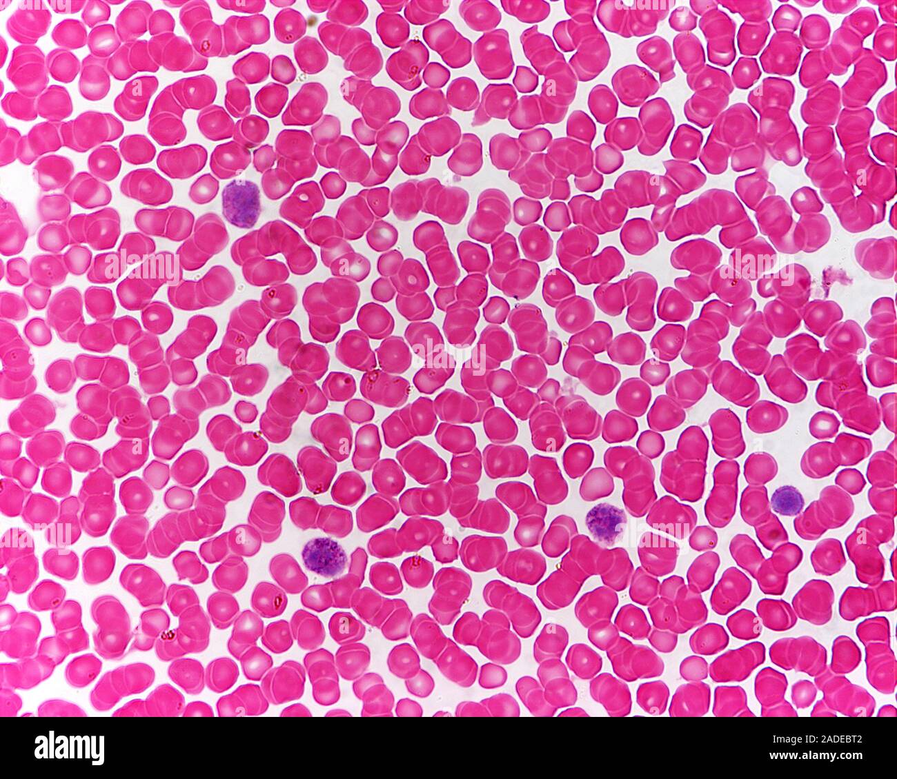 Blood cells. Light micrograph of red blood cells (erythrocytes, pink ...