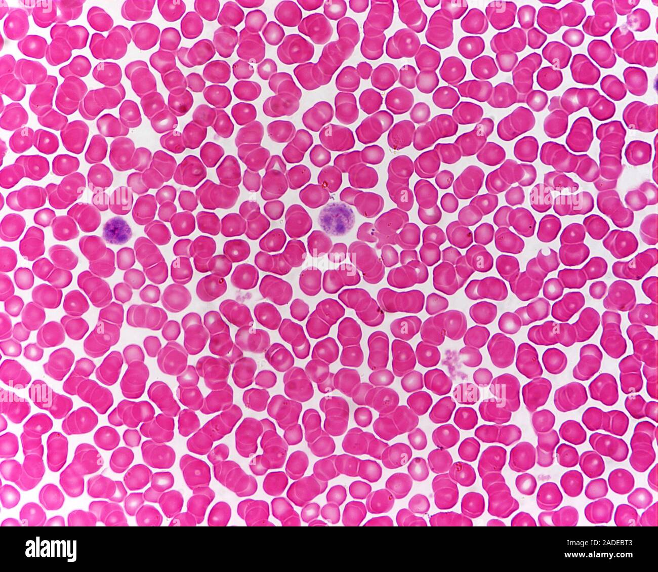 Blood cells. Light micrograph of red blood cells (erythrocytes, pink ...