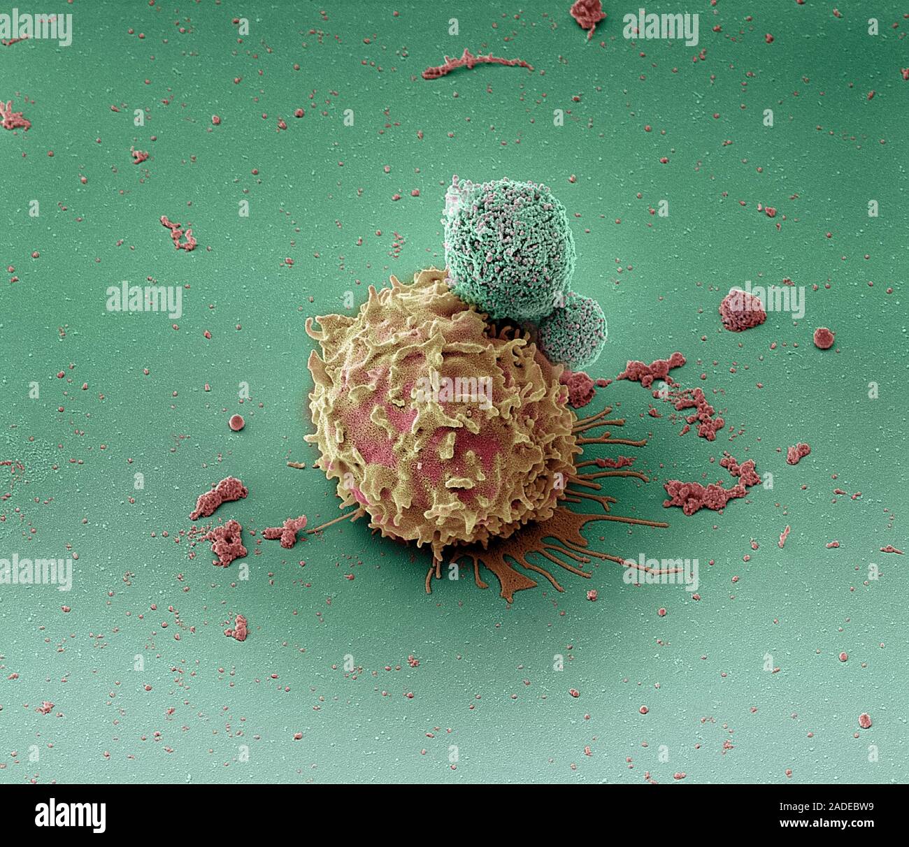 White blood cell. Scanning electron micrograph (SEM) of a white blood ...