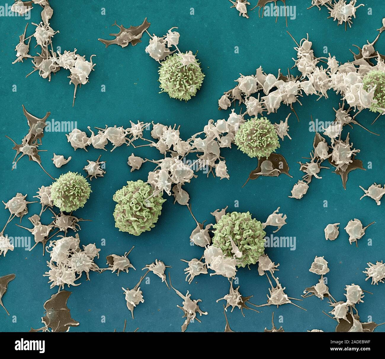 White blood cells and platelets, coloured scanning electron micrograph ...