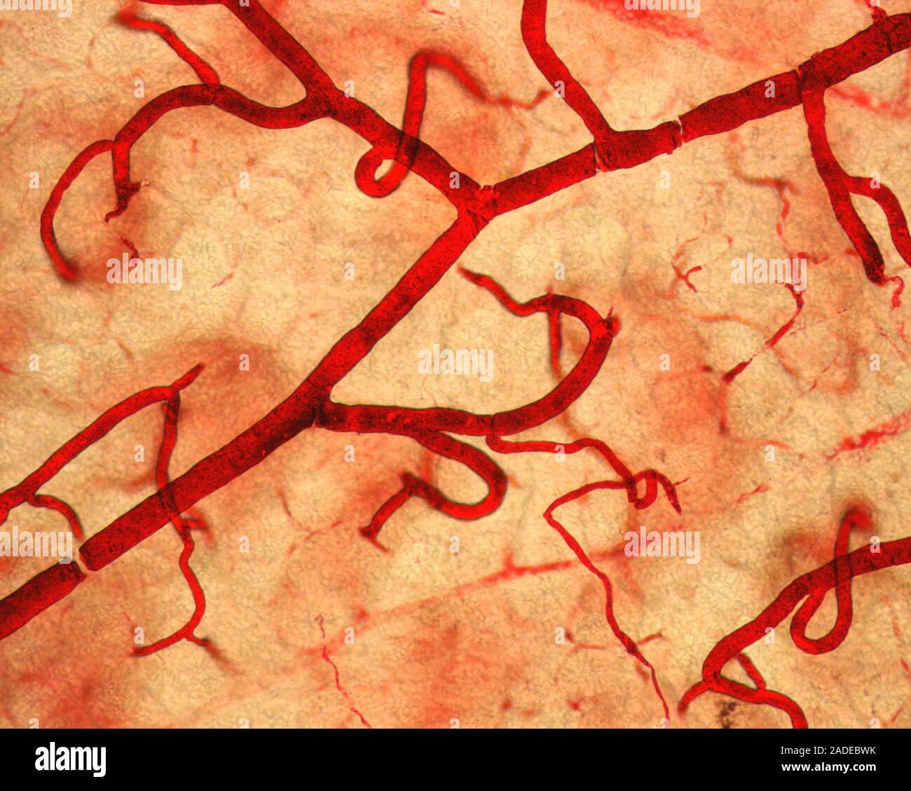 Small intestine blood vessels, light micrograph. This network of ...