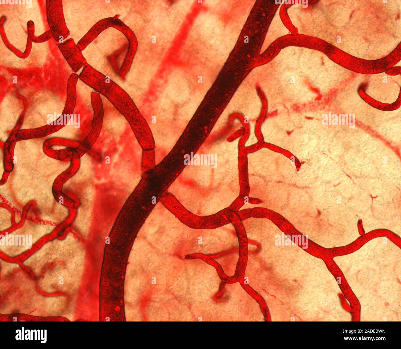 Small intestine blood vessels, light micrograph. This network of ...