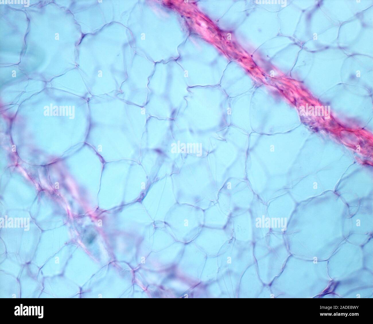 White adipose tissue, light micrograph. This type of fat is known as ...