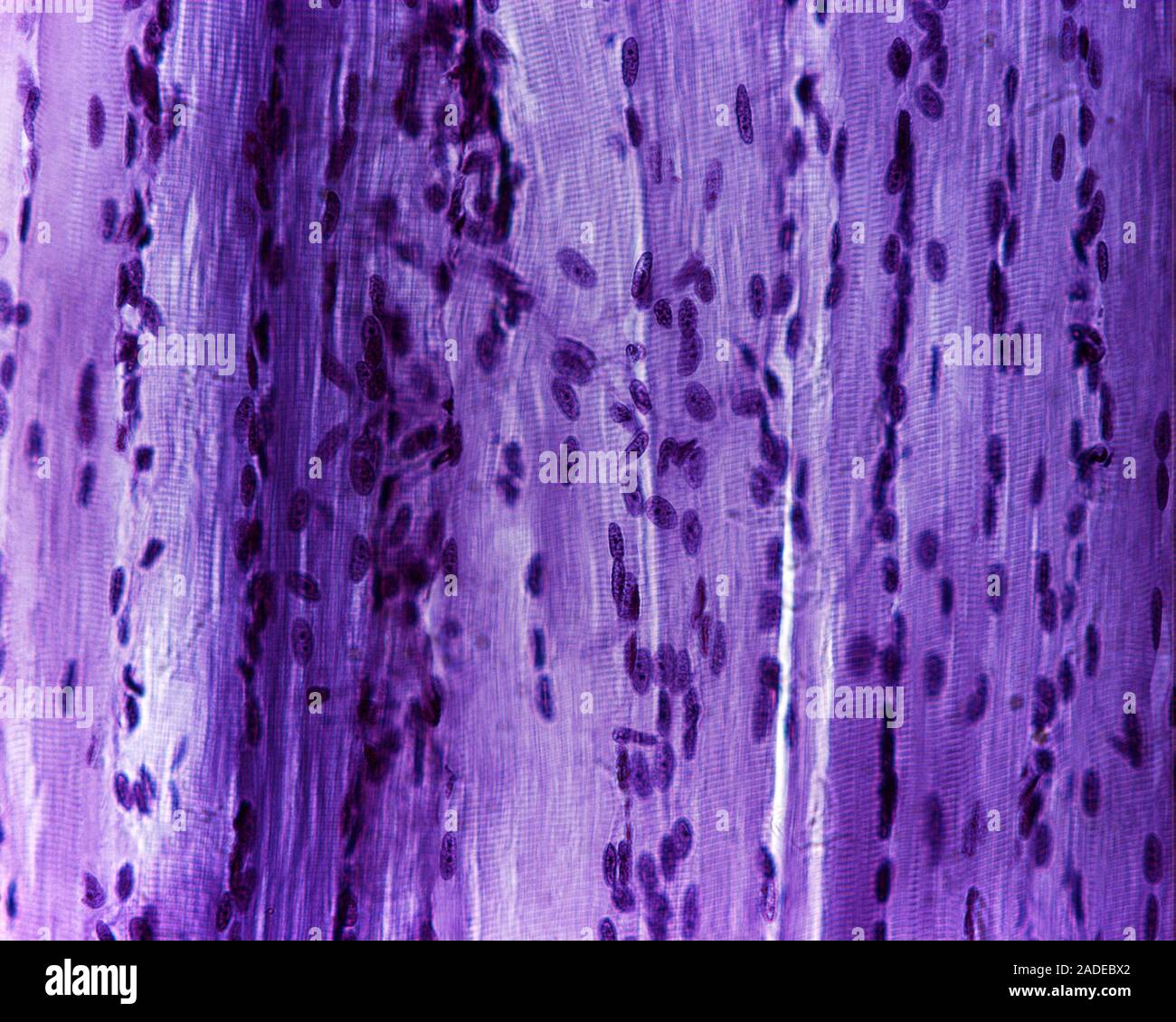 Skeletal muscle fibres. Light micrograph of a longitudinal section ...