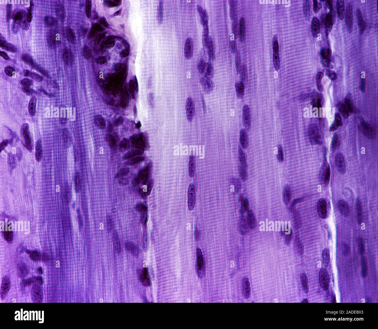 Skeletal muscle fibres. Light micrograph of a longitudinal section ...