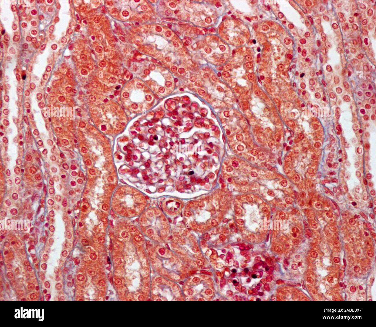 Kidney glomerulus, light micrograph. This section shows the glomerulus ...